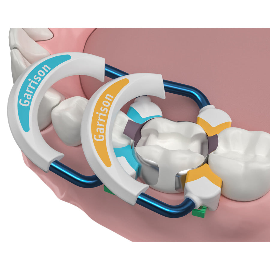 Strata-G™ Matrix Rings Curion Dental – Curion Dental Products